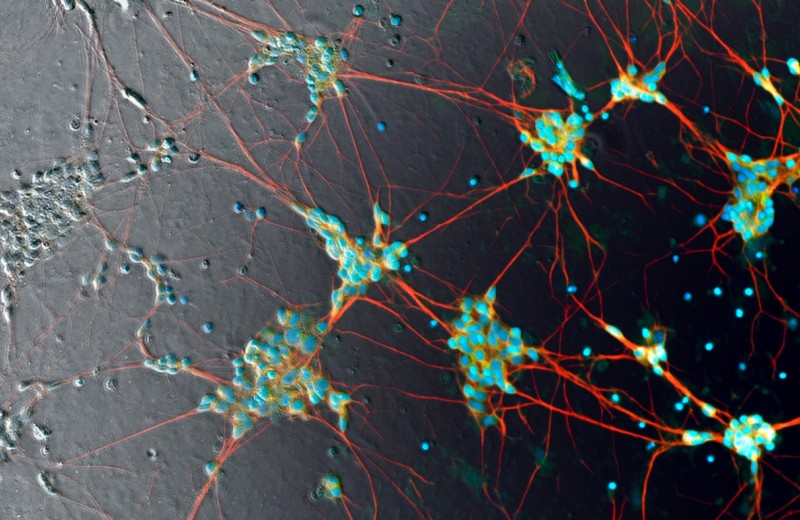 Steve Finkbeiner | Gladstone Institutes